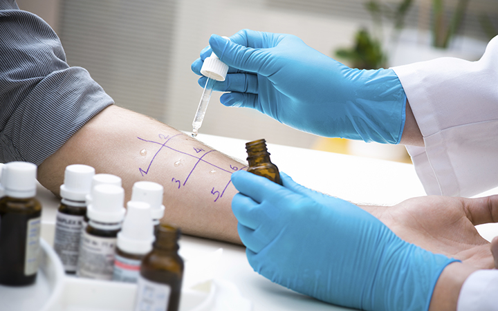 A Guide to Cannabis Allergies and Symptoms | Leafly